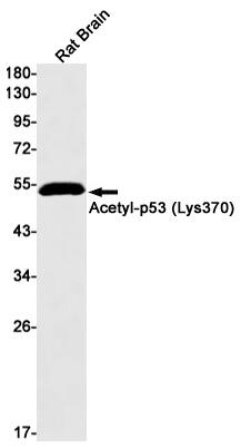 p53 [ac Lys370] Antibody (S06-7C9) (NBP3-20027): Novus Biologicals